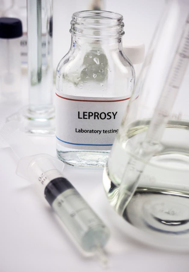 Test Leprosy in Laboratory, Conceptual Image Stock Photo - Image of ...