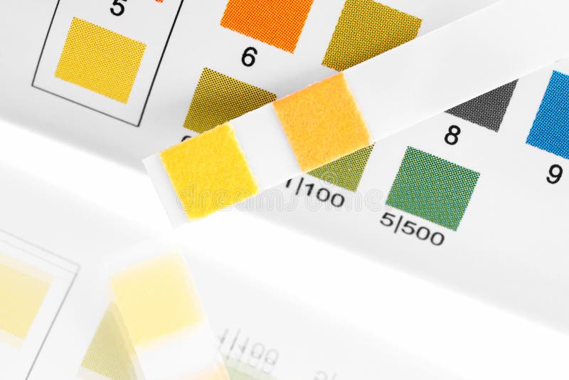 Test Strip for Control of the Urine. Stock Photo - Image of chemist ...