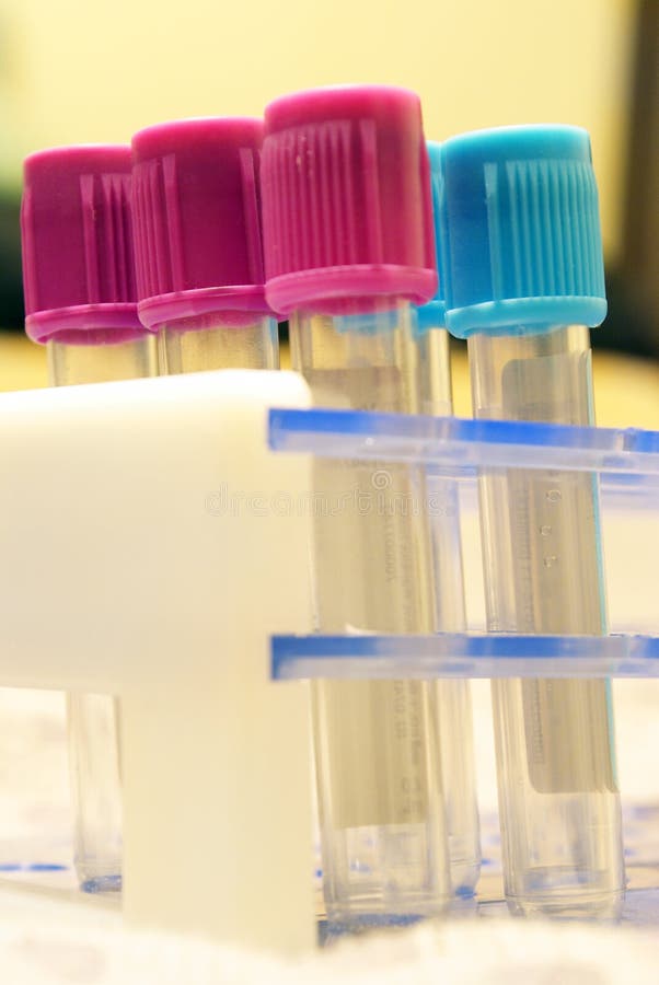 Test Tube Analysis stock image. Image of medical, healthcare - 82263559