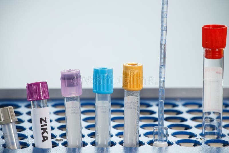 Test Tube for Analyzing ZIKA Virus Stock Image - Image of concept ...