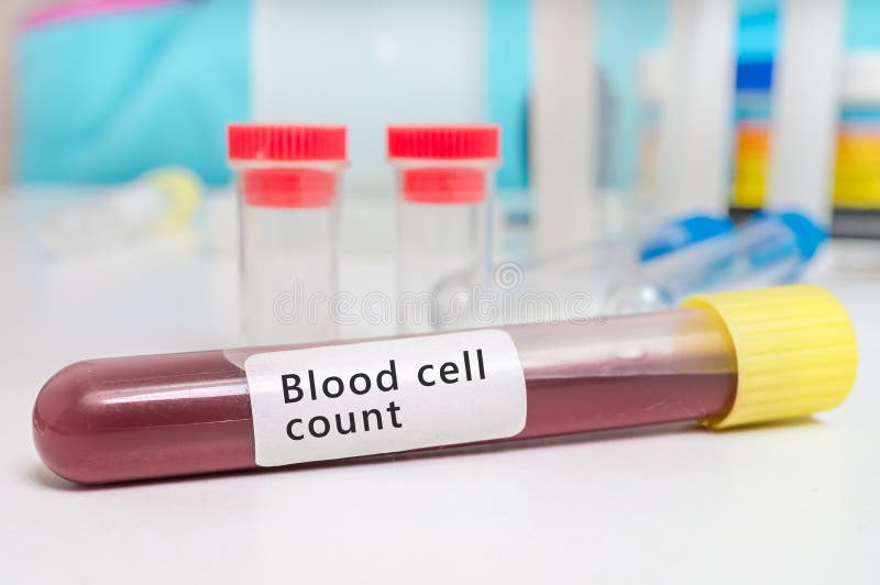 Test Tube with Blood for Blood Cell Count Test Stock Image - Image of ...