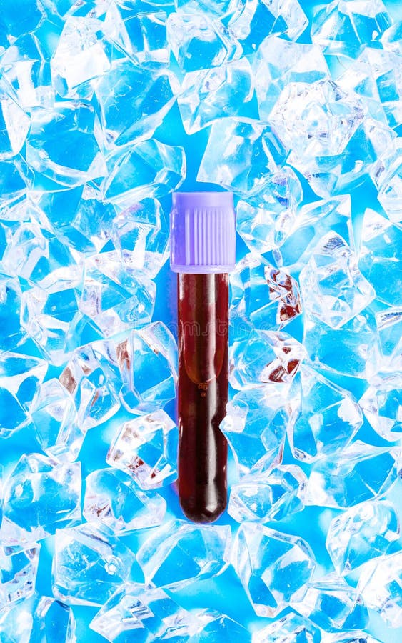 Test Tube with Blood in Ice. Blood Test. Biotest Stock Image - Image of ...