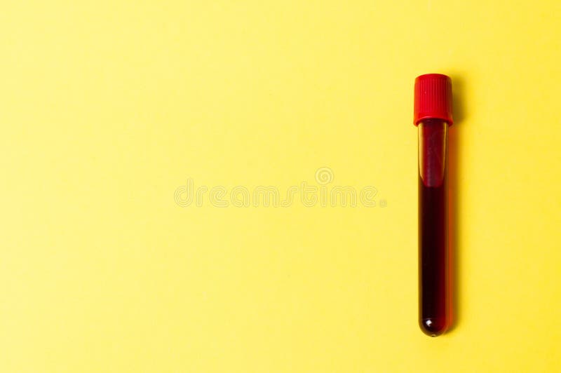 Test Tube with Blood Isolate on a Yellow Background Stock Image - Image ...