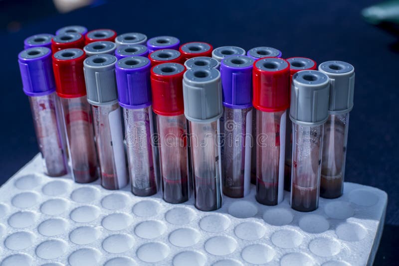 The Test Tube in the Blood Test Stock Photo - Image of organ, water ...