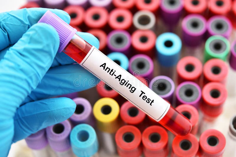 Blood Sample for Anti-aging Test Stock Photo - Image of serum ...