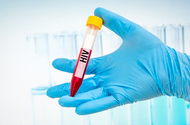 Test-tube with Blood Sample for HIV or AIDS Test Stock Photo - Image of ...