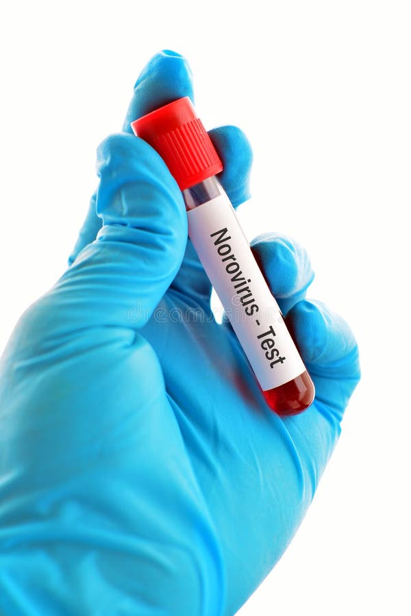 Blood Sample for Norovirus Test Stock Image - Image of exam, test ...