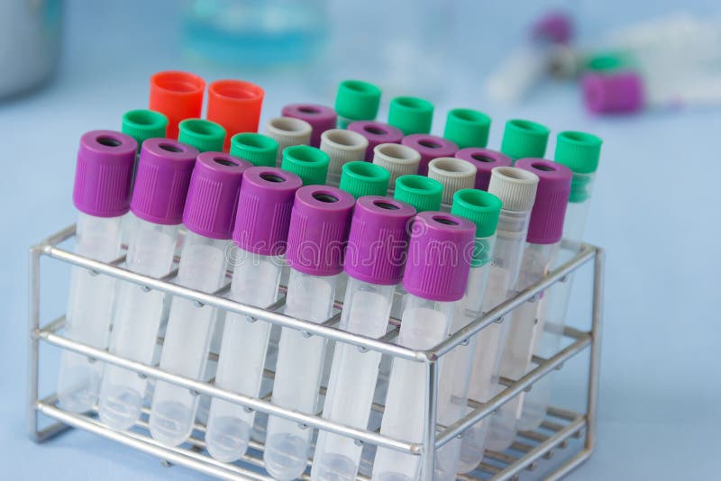 Test tube blood specimen stock photo. Image of medical - 57971068