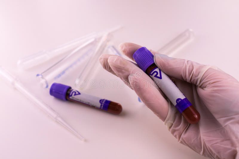 Test Tube with Blood Tests in the Hand of a Medical Worker. Stock Photo ...