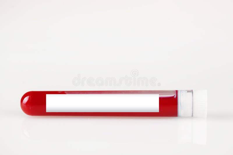 Test Tube with Blood and White Sticker on White. Background with Copy ...