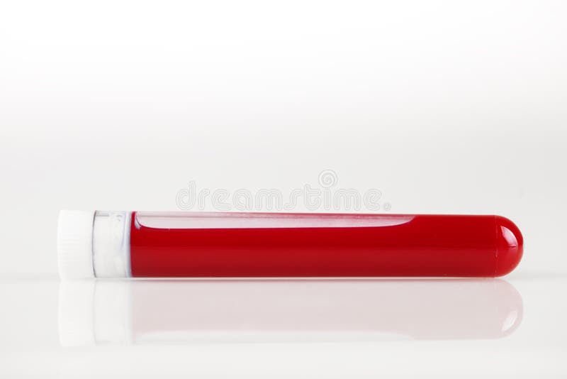 Test Tube with Blood and White Sticker on White. Background with Copy ...