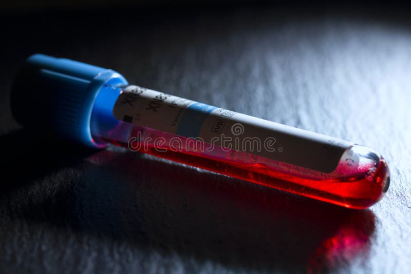 Test Tube Containing a Blood Sample . Dramatic Light Stock Image ...