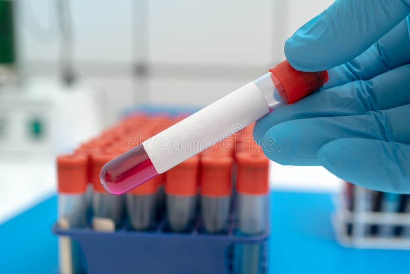 Test Tube with Empty Label To Laboratory Research Stock Image - Image ...