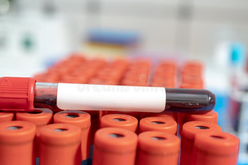 Test Tube with Empty Label To Laboratory Research Stock Photo - Image ...