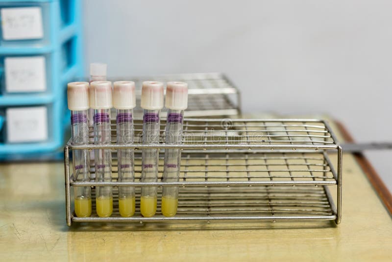 Test tube stock image. Image of medicine, technology - 62336491