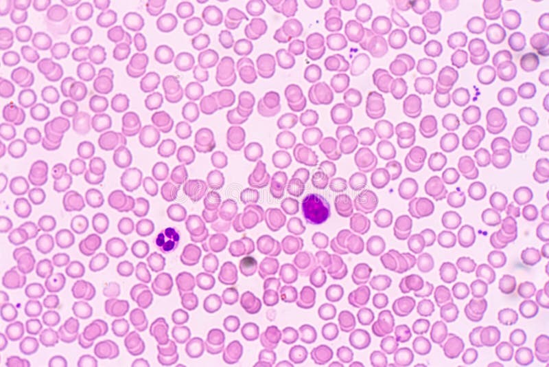 White Blood Cells are the Cells of the Immune System Under the ...