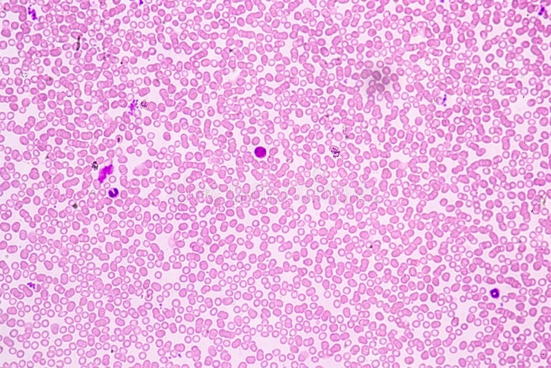 White Blood Cells are the Cells of the Immune System Under the ...