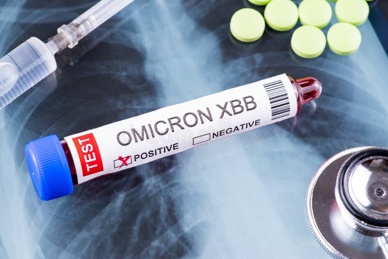 Test Tube Labelled "OMICRON XBB Variant Test Positive" Stock Photo ...