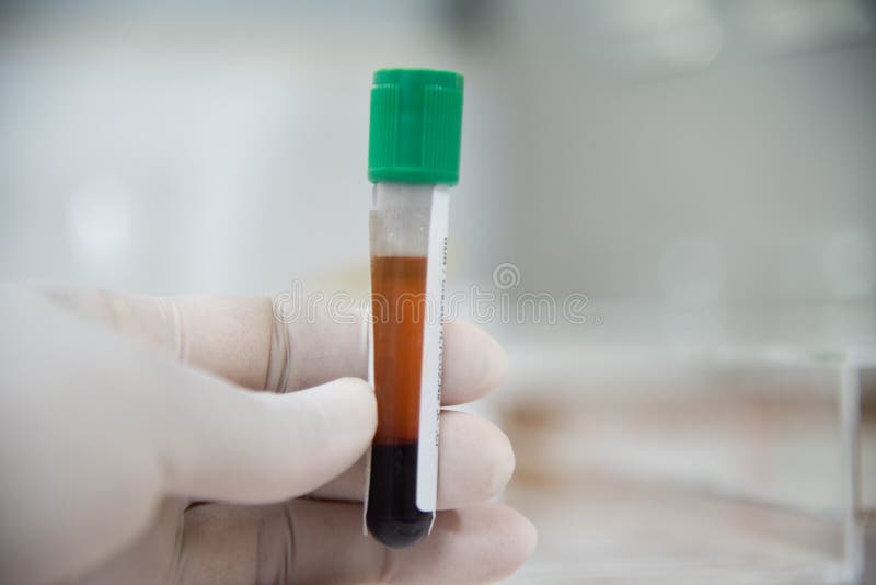 Test Tube in Laboratory Testing Stock Image - Image of male ...