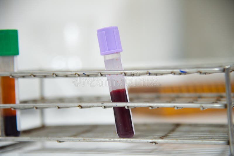 Test Tube in Laboratory Testing Stock Image - Image of coronavirus ...