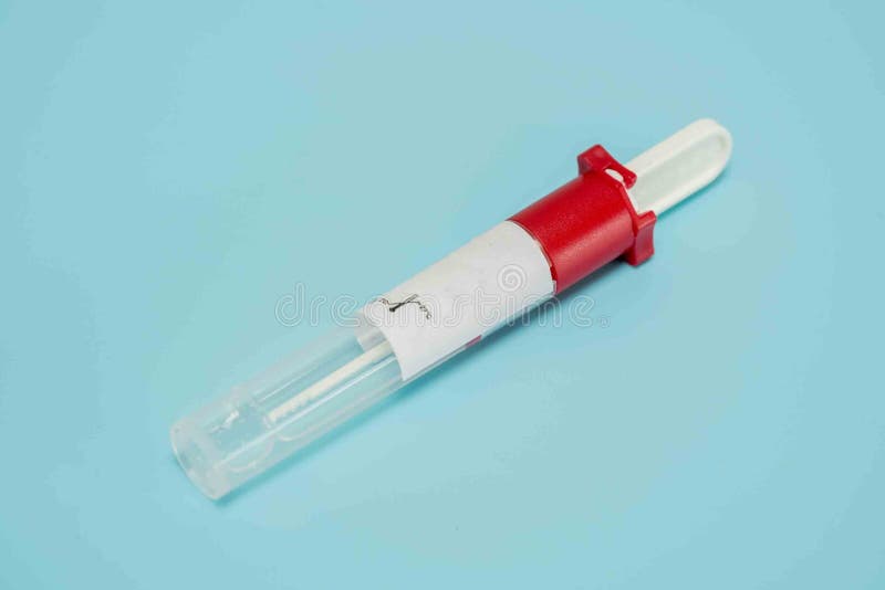 Test Tube for Taking Stool Samples. Stock Photo - Image of experiment ...