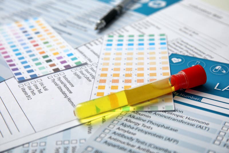 Test Tube with Urine Sample for Analysis on Test Form Stock Image ...