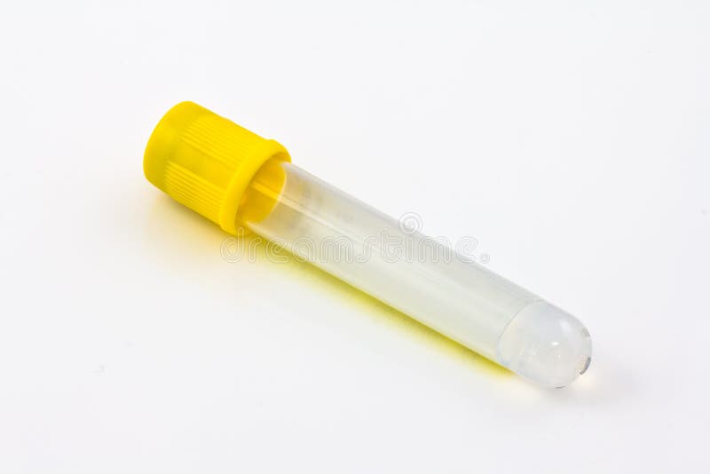 Test tube with yellow plug stock image. Image of glass - 33988997