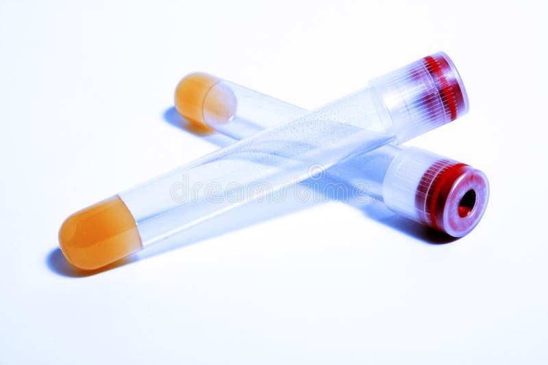 Test tubes in rack stock image. Image of healthcare, forensic - 12051557