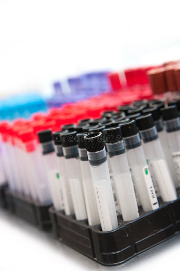 Blood Test Laboratory Worker Stock Photo - Image of works, blood: 14015986