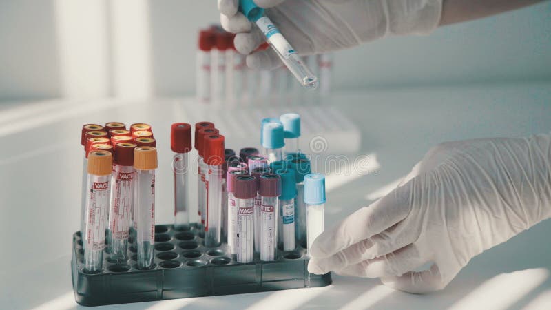 Test Tubes with Assay Samples. Hands of a Lab Technician with a Tube ...