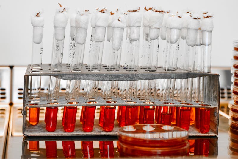 Test Tubes with Bacteriological Cultures Installed in Tripod Stock ...