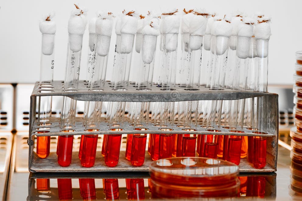 Test Tubes with Bacteriological Cultures Installed in Tripod Stock ...