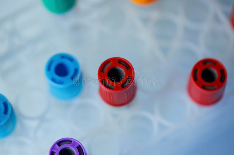 Test Tubes for Blood Analysis Stock Image - Image of sampling, device ...