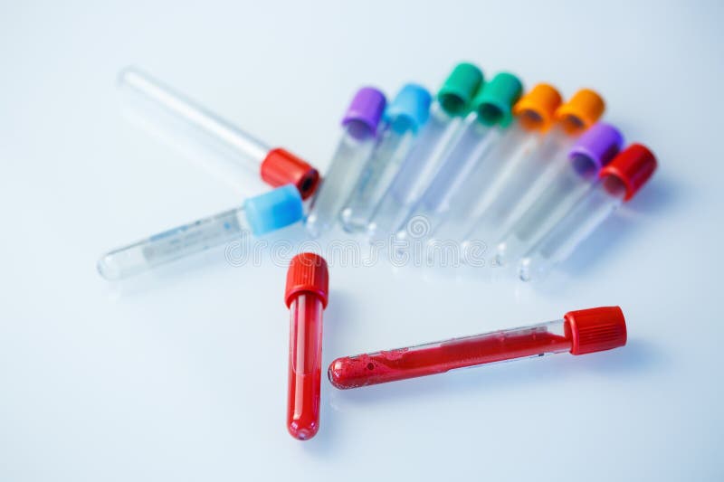 Test Tubes for Blood Analysis Stock Photo - Image of equipment, exam ...
