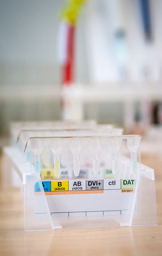 Test Tubes for Blood Group Matching. Stock Image - Image of analysis ...