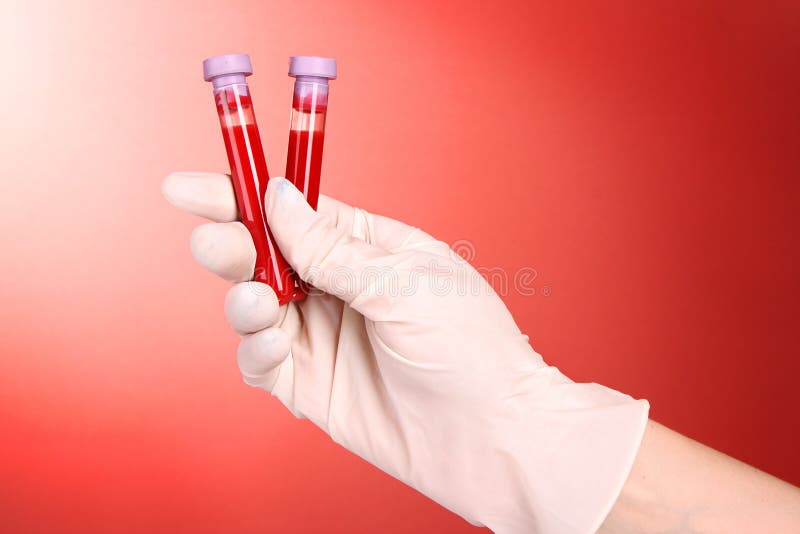 Test Tubes with Blood in Hand Stock Image - Image of finger, background ...