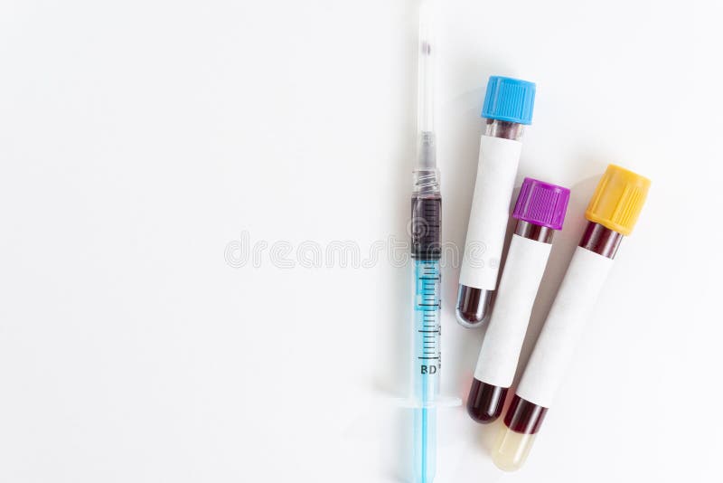 Test Tubes with Blood Isolated and Syringe on White. Top View Stock ...