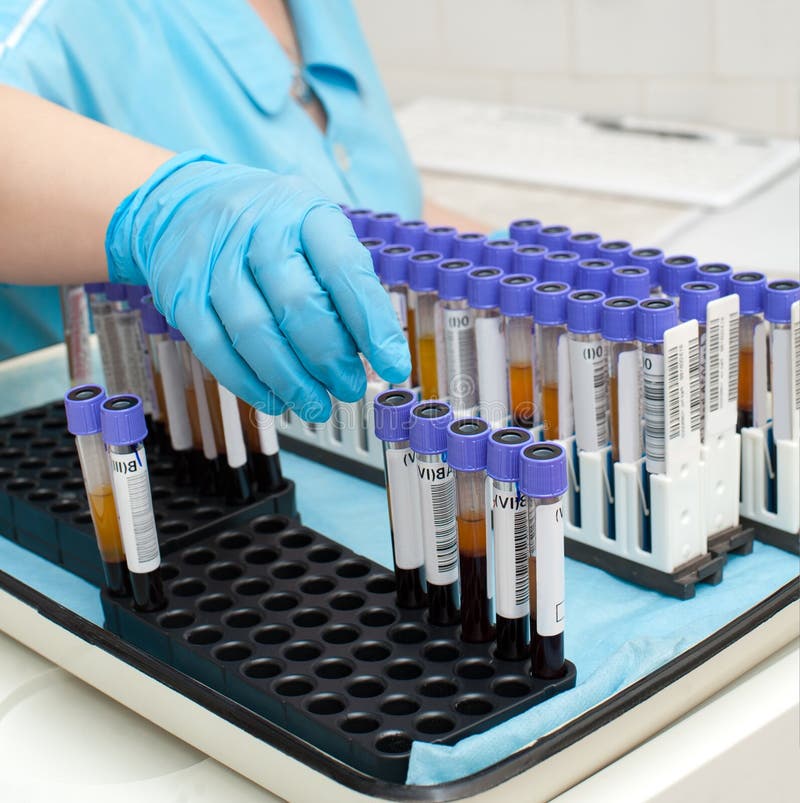 442 Blood Tubes Tray Photos - Free & Royalty-Free Stock Photos from ...