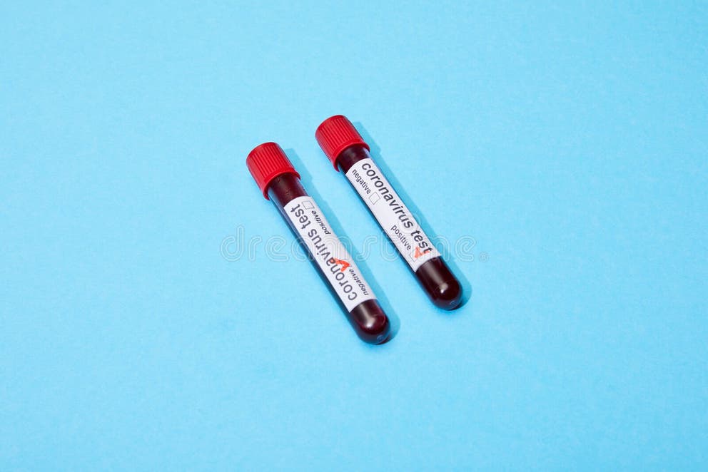 Test Tubes with Blood Samples and Coronavirus Test Lettering Stock ...