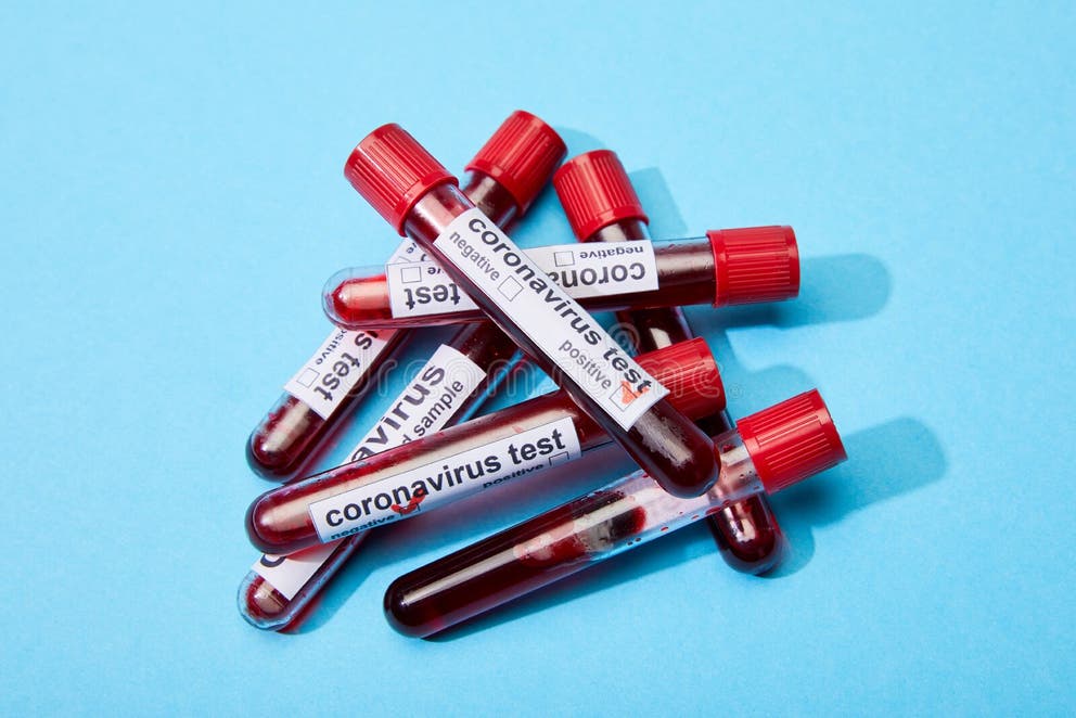 Test Tubes with Blood Samples and Coronavirus Test Lettering Stock ...