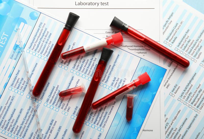 Test Tubes with Blood Samples on Forms, Top View Stock Image - Image of ...