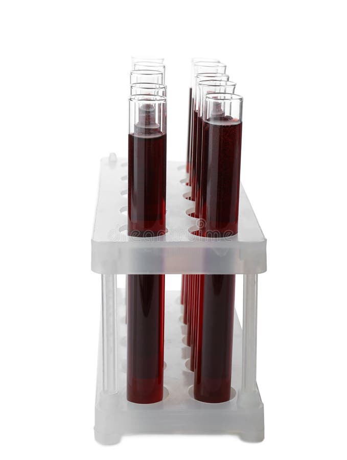 258 Medical Test Tubes Blood Holder Stock Photos - Free & Royalty-Free ...