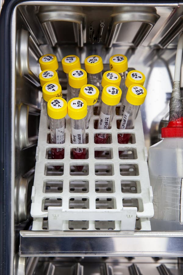 Test Tubes with Blood Samples in the Incubator during the Process of ...