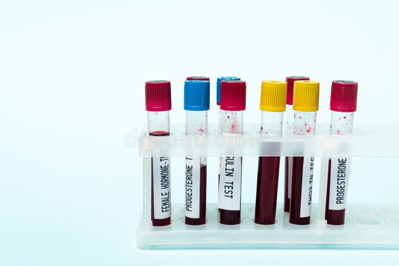 Tubes with Blood Samples of Insulin Stock Image - Image of biology ...
