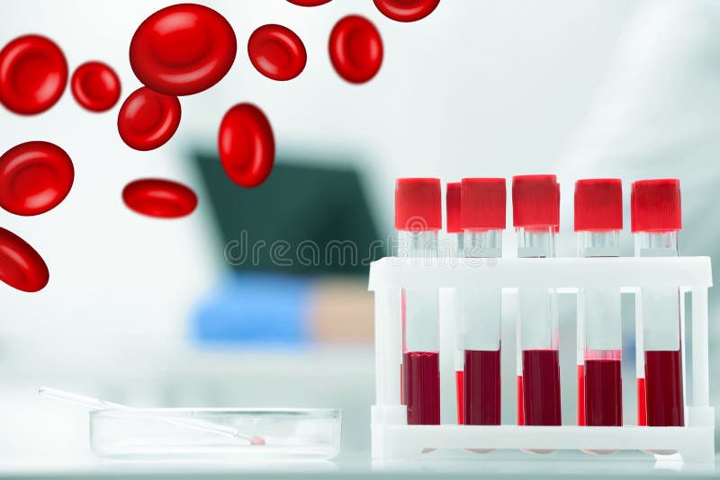Test Tubes with Blood Samples in Laboratory and Illustration of ...