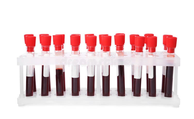 Rack Of Blood Tubes Labeled In Blood Bank Lab Stock Photo - Image of ...