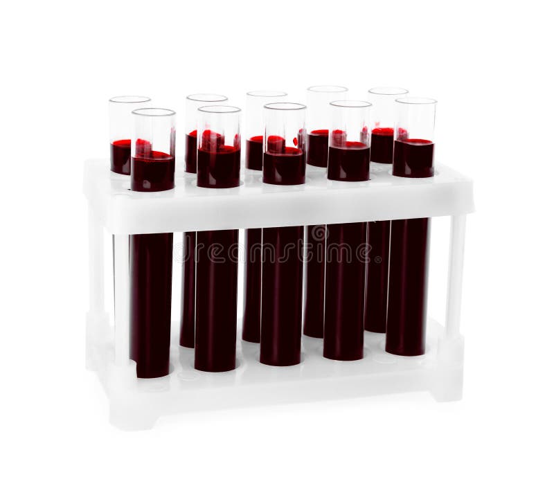 895 Blood Test Tubes Rack Stock Photos - Free & Royalty-Free Stock ...