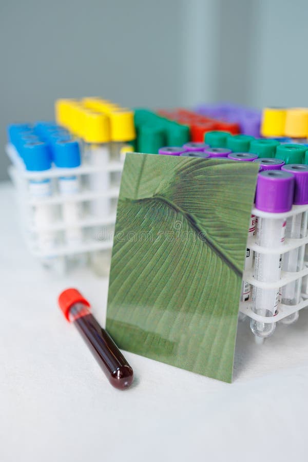 Test Tubes with Blood. Taking Stock Image - Image of sample, scientific ...