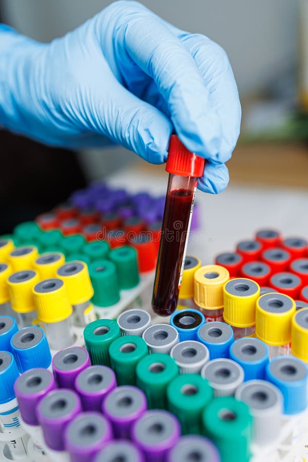 Test Tubes with Blood. Taking Stock Photo - Image of diagnostic, label ...