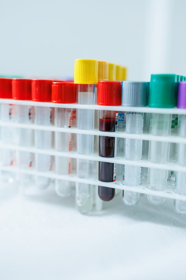Test Tubes with Blood. Taking Stock Photo - Image of clinical, hospital ...